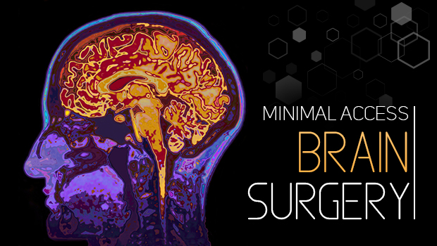 Minimal Access Brain Surgery | Apollo Hospitals